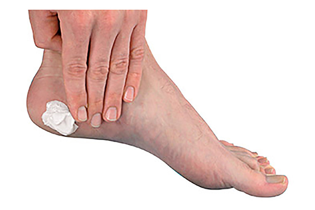 PediFix Podiatrists’ Choice® Callus Control Cream™ - FootSmart